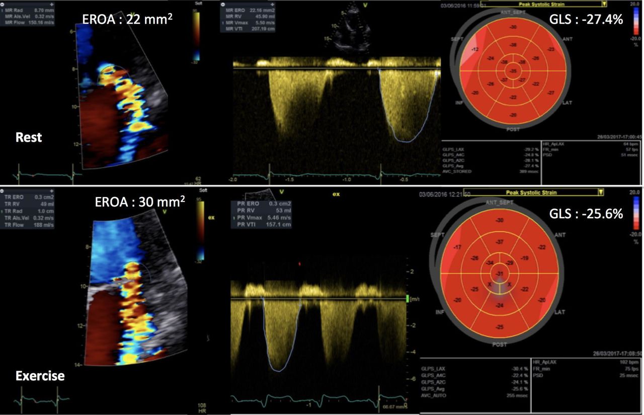 Heart Diagnostic Tests in Mira Road | ECG, 2D Echo, Stress Test & Holter