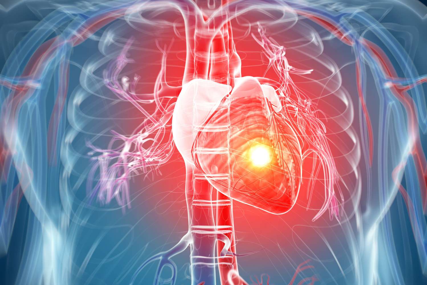 Cordis Heart Institute – Alternative to bypass surgery